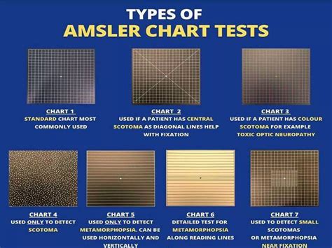 Visual Field Evaluation Pptx