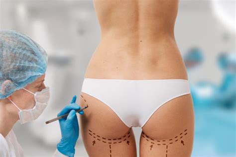 Fat Transfer To The Buttocks What You Should Know About The Brazilian