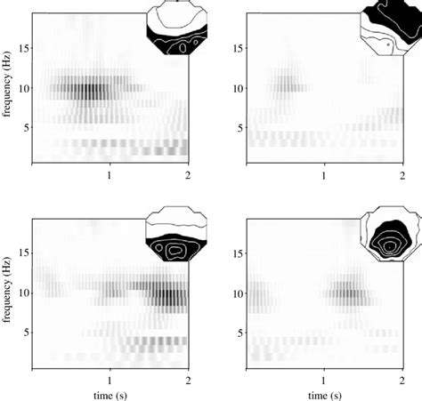 Time Frequency Decomposition Of The Eeg Shown In Figure 3 The Four Download Scientific Diagram