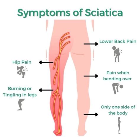 2 Major Distinctions Between Sciatica And Spinal Stenosis