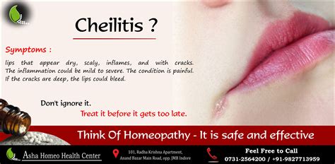 Common Causes Of Recurrent Lip Rashes Cheilitis