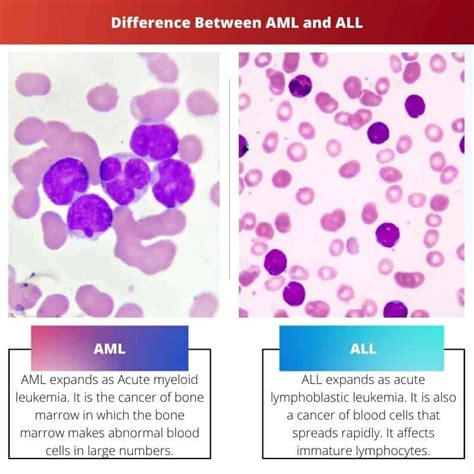 Aml Vs All Difference And Comparison
