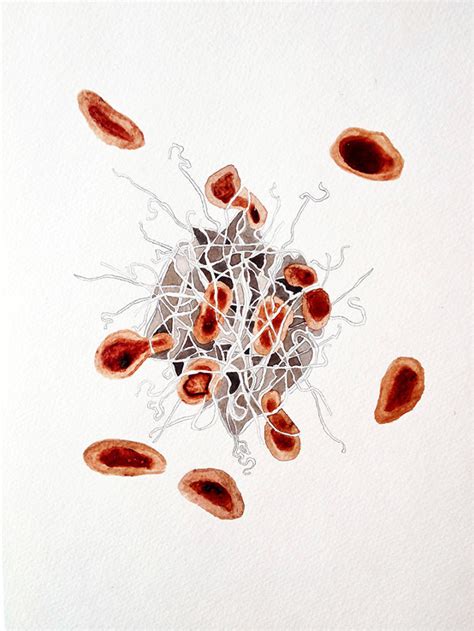 Factor Xiii Ash Conrad