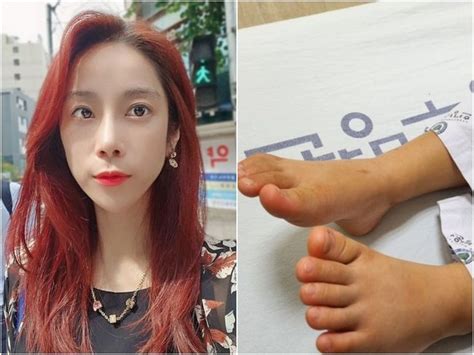 인`스타`그램 세상 조민아 4세 아들 사고 `얼굴에 구멍 뚫리고 화상응급실 뱅뱅이 지옥` 전문 Zum 뉴스