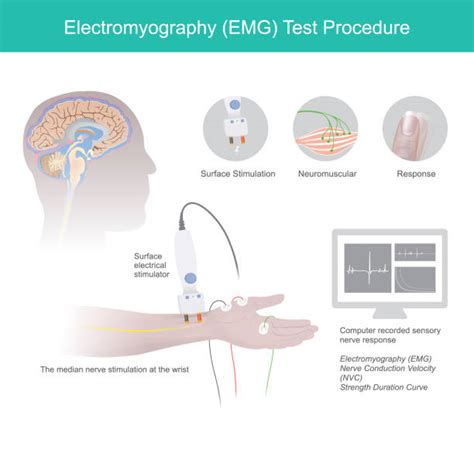 10 Electromyography Stock Illustrations Royalty Free Vector Graphics
