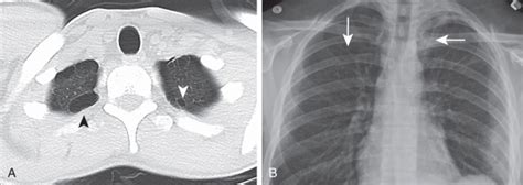 The Postoperative Chest Clinical Tree