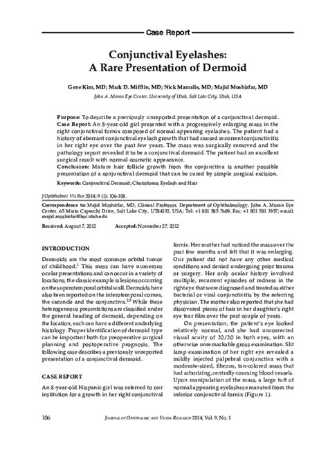 Pdf Conjunctival Eyelashes A Rare Presentation Of Dermoid