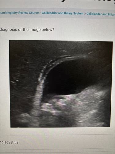 Gallbladder And Biliary Pathology Quiz Flashcards Quizlet