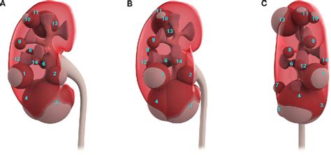 Figure 1 From The Small Size And Superficial Location Suggest That