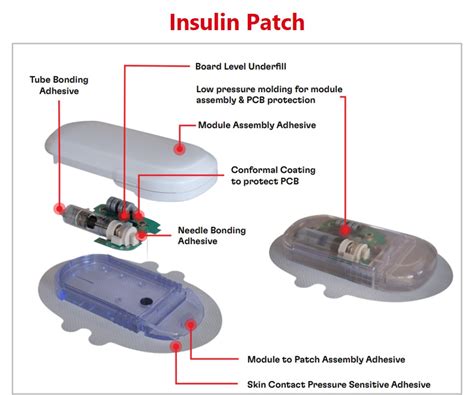 Henkel Introduces New Medical Grade Wearables Device Light Cure Adhesives