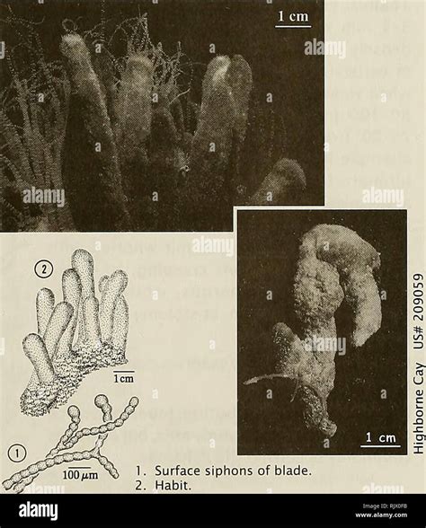 Phylum Chlorophyta Under Microscope