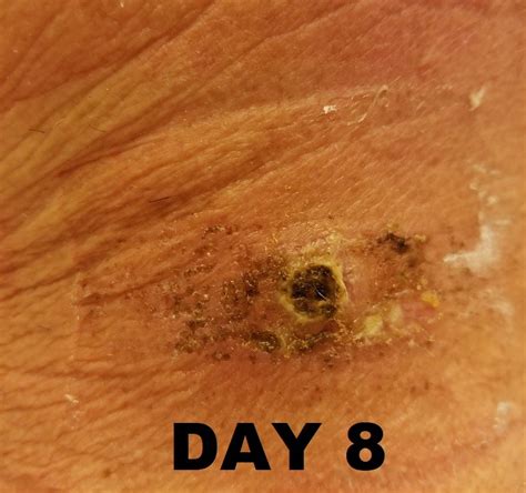 Bloodroot The Experiment Power In Surrender