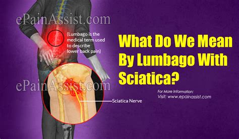 Lumbago With Sciatica Causes Symptoms Treatment