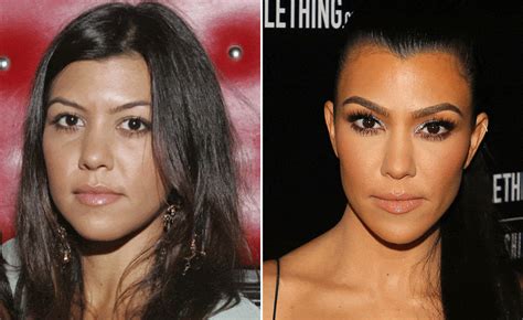 Kourtney Kardashian Nose Job 2024