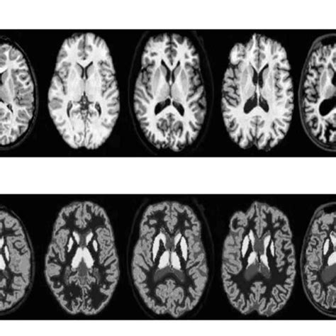 Process Of Three Dimensional 3d Multimodal Medical Image Segmentation Download Scientific