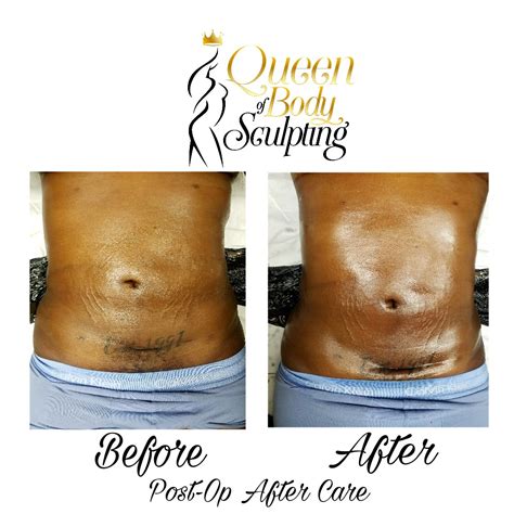 Body Sculpting Queen At Hunter Langham Blog