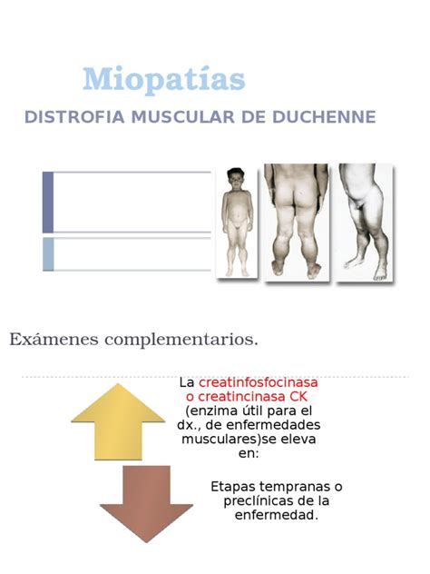 Miopatias Pdf Sistema Musculoesquelético Enfermedades Y Trastornos