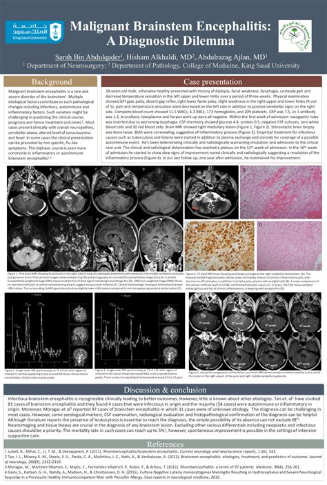 Pdf Malignant Brainstem Encephalitis A Diagnostic Dilemma