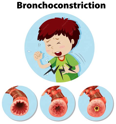 Premium Vector Human Anatomy Bronchoconstriction On White Background