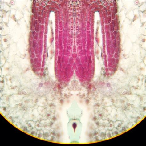 These Images Are Manipulations Of Slides Of Embryonic Development In A Dicot Angiosperm The