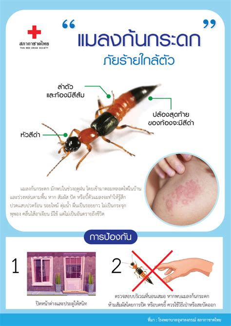 แมลงก้นกระดก ภัยร้ายใกล้ตัว เว็บไซต์สภากาชาดไทย ภาษาไทย