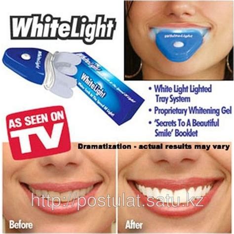 The Device For Bleaching Of Teeth In House Conditions Buy In Uralsk
