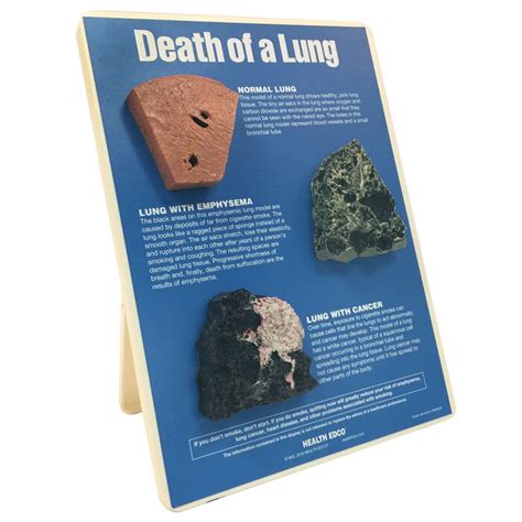 How Smoking Destroys The Lungs Easel Display Health Edco