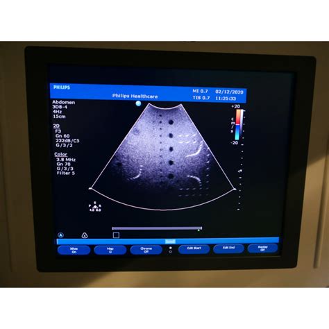 Philips 3d8 4 3d 4d Convex Probe Transducer