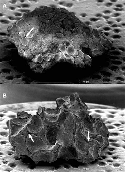 Sem Analysis Of The Two Types Of β Tcp Granules A Lp Granules