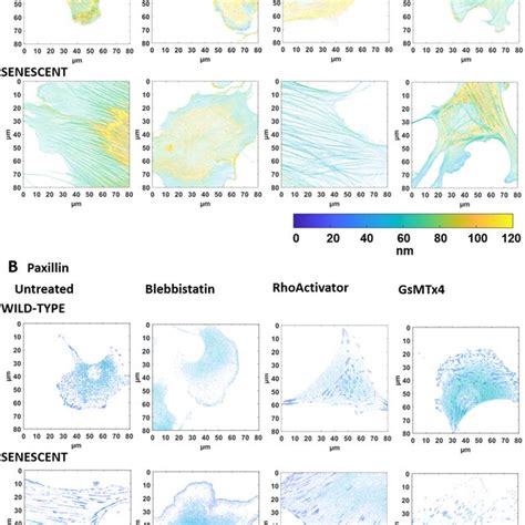 Area Of Wild Type And Senescent Fibroblasts Untreated Blebbistatin