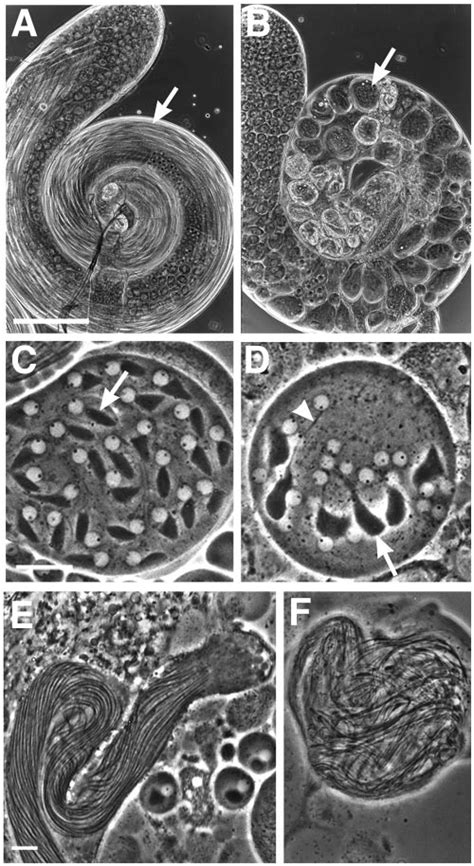 Spermatid Elongation Defects In Fws Testes Viewed By Phase Contrast