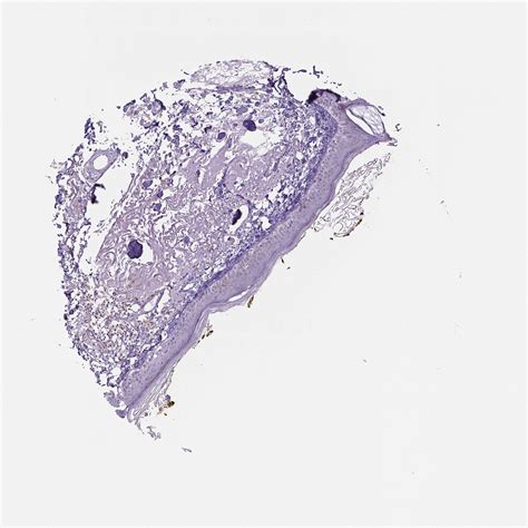 Tissue Expression Of Itgam Staining In Skin The Human Protein Atlas