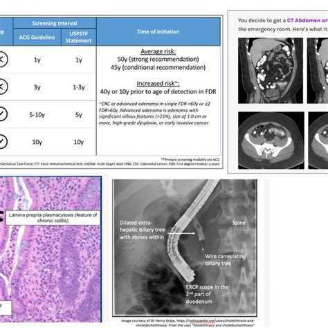 Sampling Of Infographics Radiologic Histologic And Endoscopic Images
