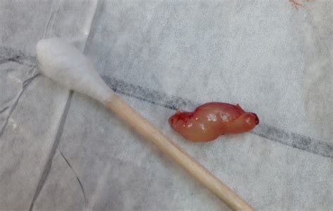 Oropharyngeal Polyp Virtuavet