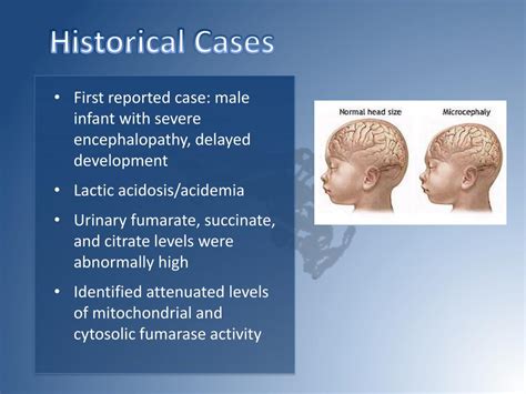 Ppt Fumarase Deficiency Powerpoint Presentation Free Download Id 1728119