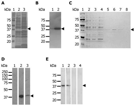 4x Laemmli Buffer Recipe Banana