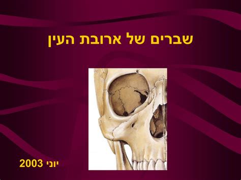 Ppt שברים של ארובת העין Powerpoint Presentation Free Download Id3764026