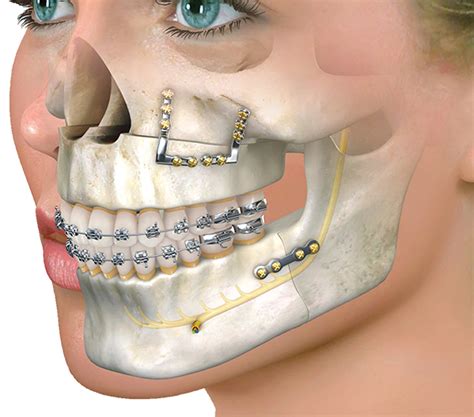 Oral And Maxillofacial Surgery Domonique Sanges