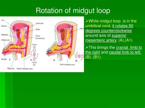 Ppt Development Of Midgut Loop Powerpoint Presentation Id 5381075