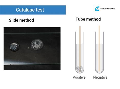 Microbial Notes On Linkedin Understanding The Catalase Test Principle