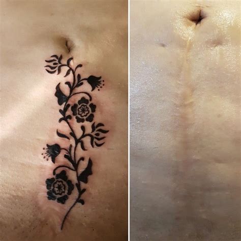 Scar Birthmark Tattoo Cover Ups Artofit