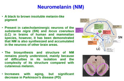 Summary Of Icms Journal Club Presentation On Friday June 25 2021