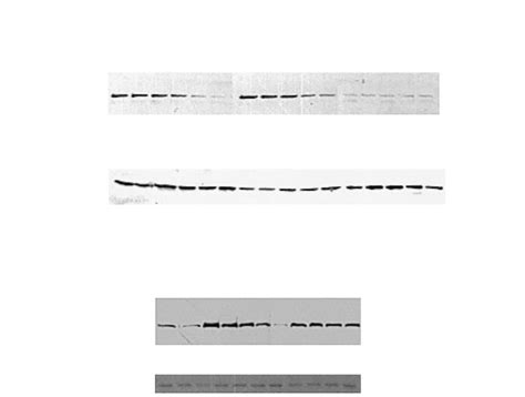 Effects Of Dex On Cas And C Myc Expression In Human Hepatocytes The