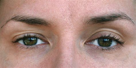 Why Do My Eyelids Feel Heavy Causes And Solutions