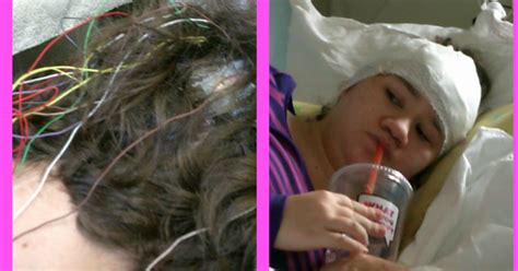 Firefly United States Dangerous And Annoying Epilepsy Misconceptions