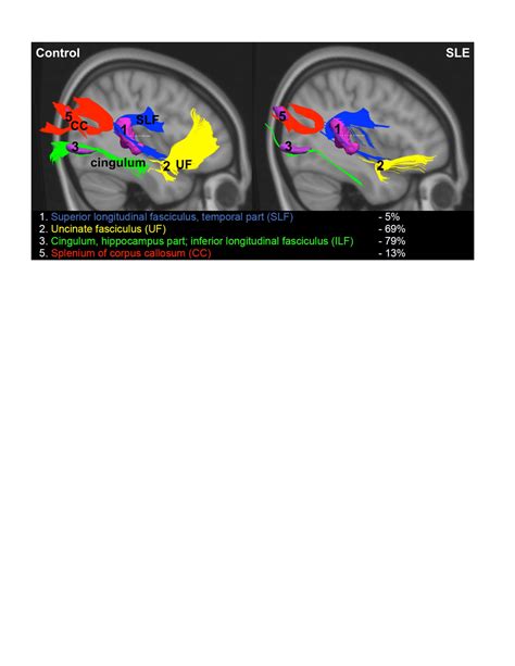 Quinolinic Acid A Kynureninetryptophan Pathway Metabolite Correlates With Abnormalities In