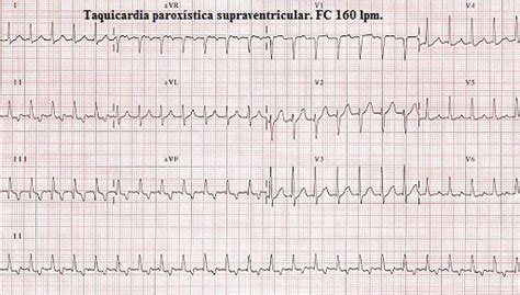 Dr Rafael Soto Electrocardiografía Cardiología Clínica