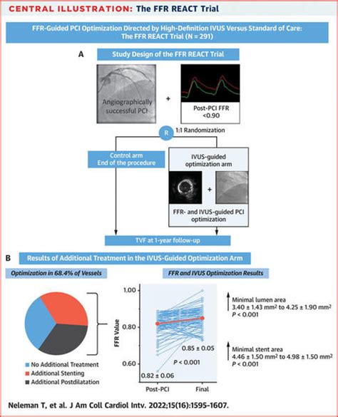 Ffr Guided Pci Optimization Directed By High Definition Ivus Versus