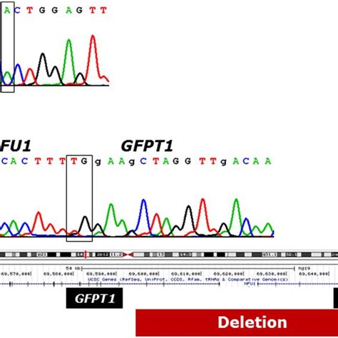 Genetic Analysis Of Patient 1 A Electropherogram Of The Strand Of