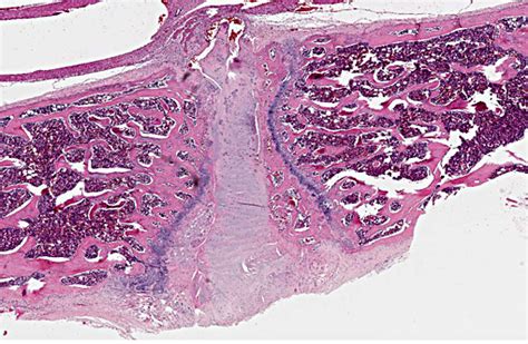Annulus Fibrosus Histology